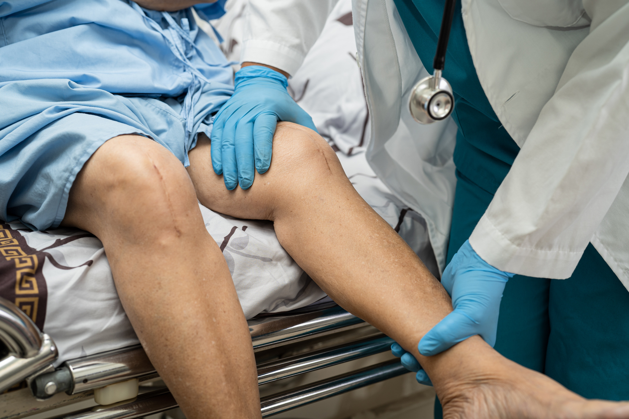 Surgical Never Event - Case Study: Surgery on the Wrong Knee
