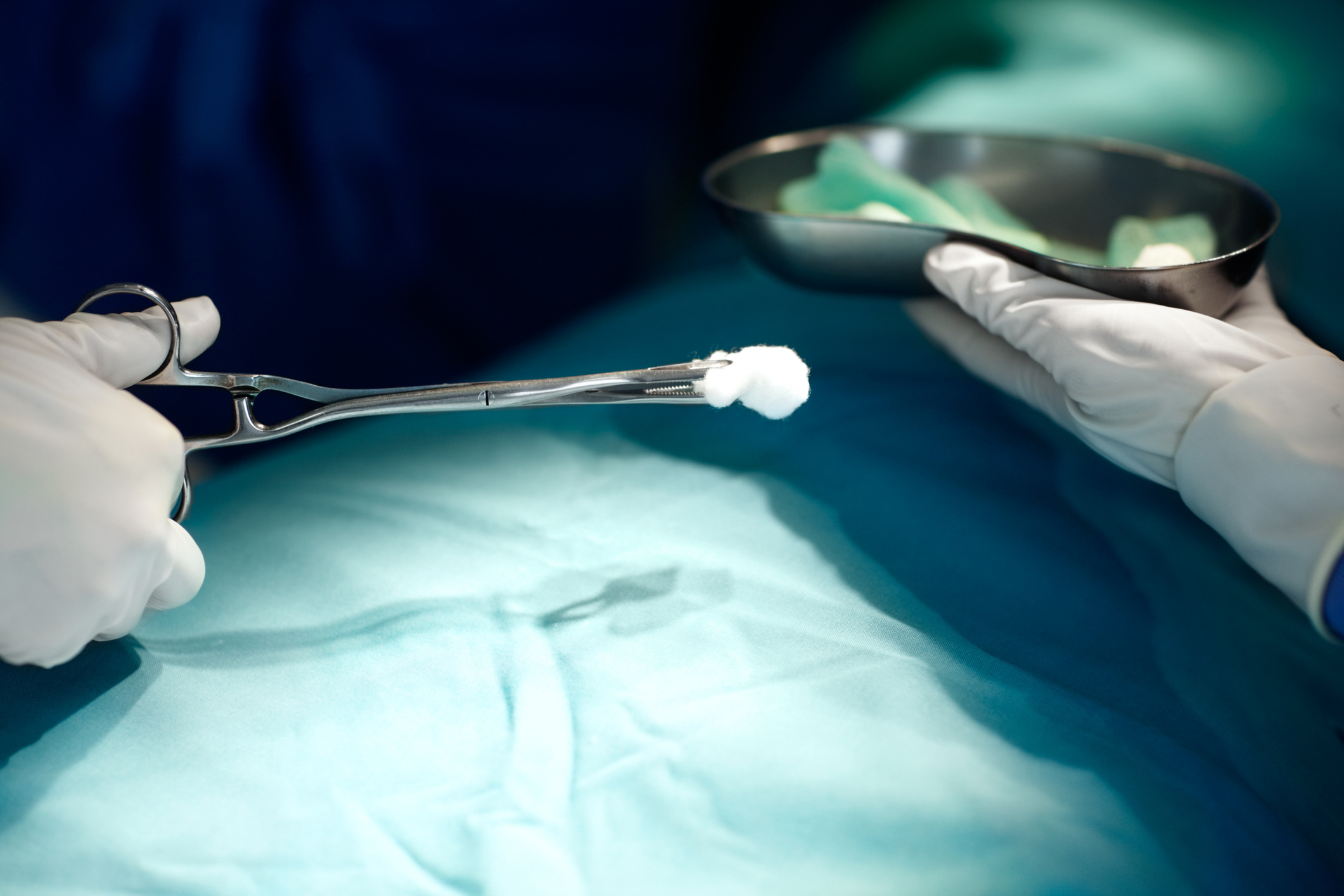 Surgical Never Event - Case Study: Retained Lap Pad